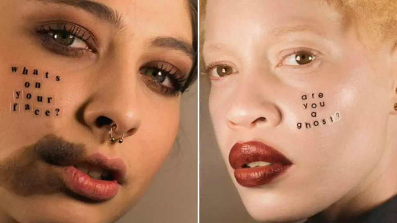 Questa serie di ritratti mette in evidenza i commenti maleducati che le persone con malattie della pelle sentono ogni giorno