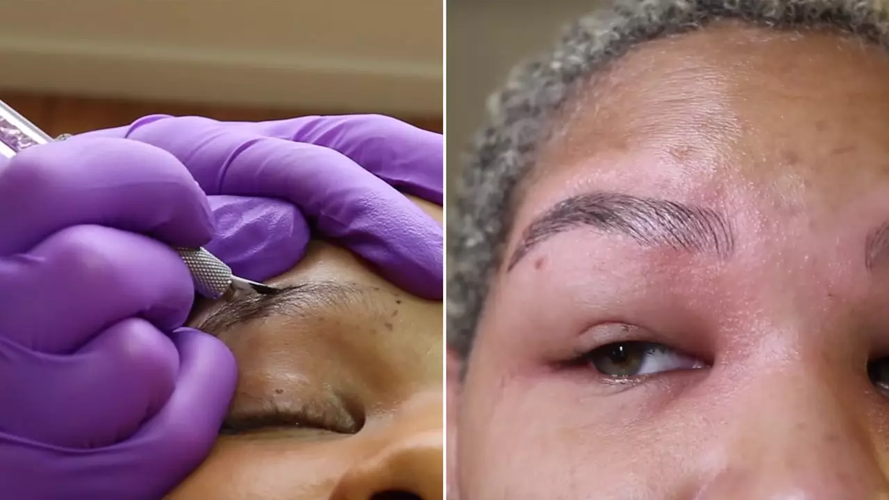 YouTube Ulduzu Microblading-ə Dəhşətli Allergik Reaksiyasını Açıqladı