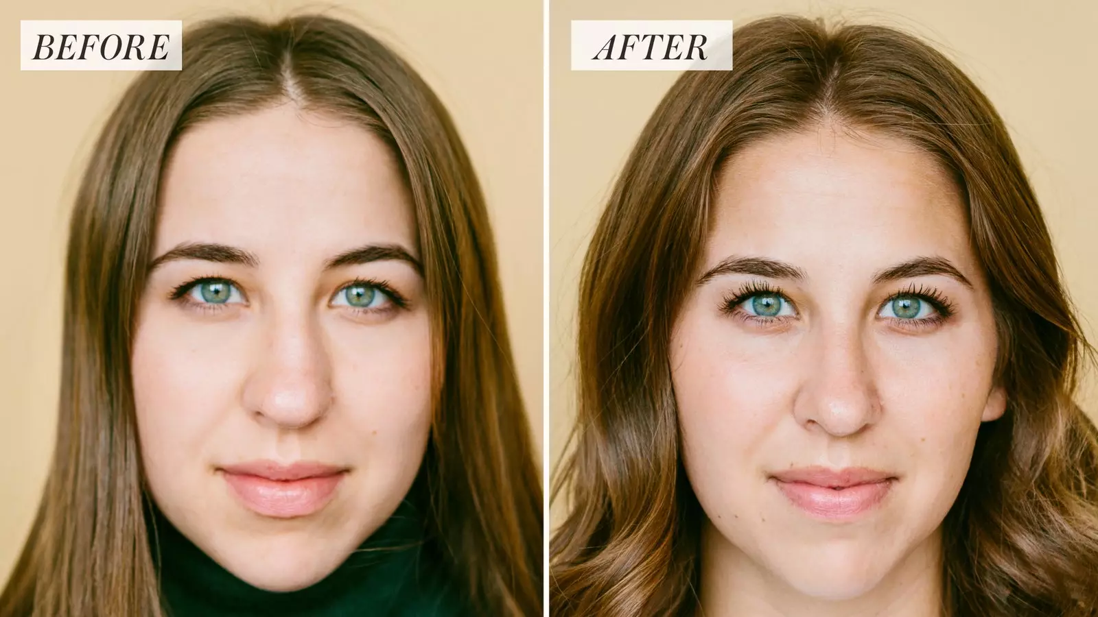 rinoplastia antes y fotos para la vida de allure.com en columna de plástico