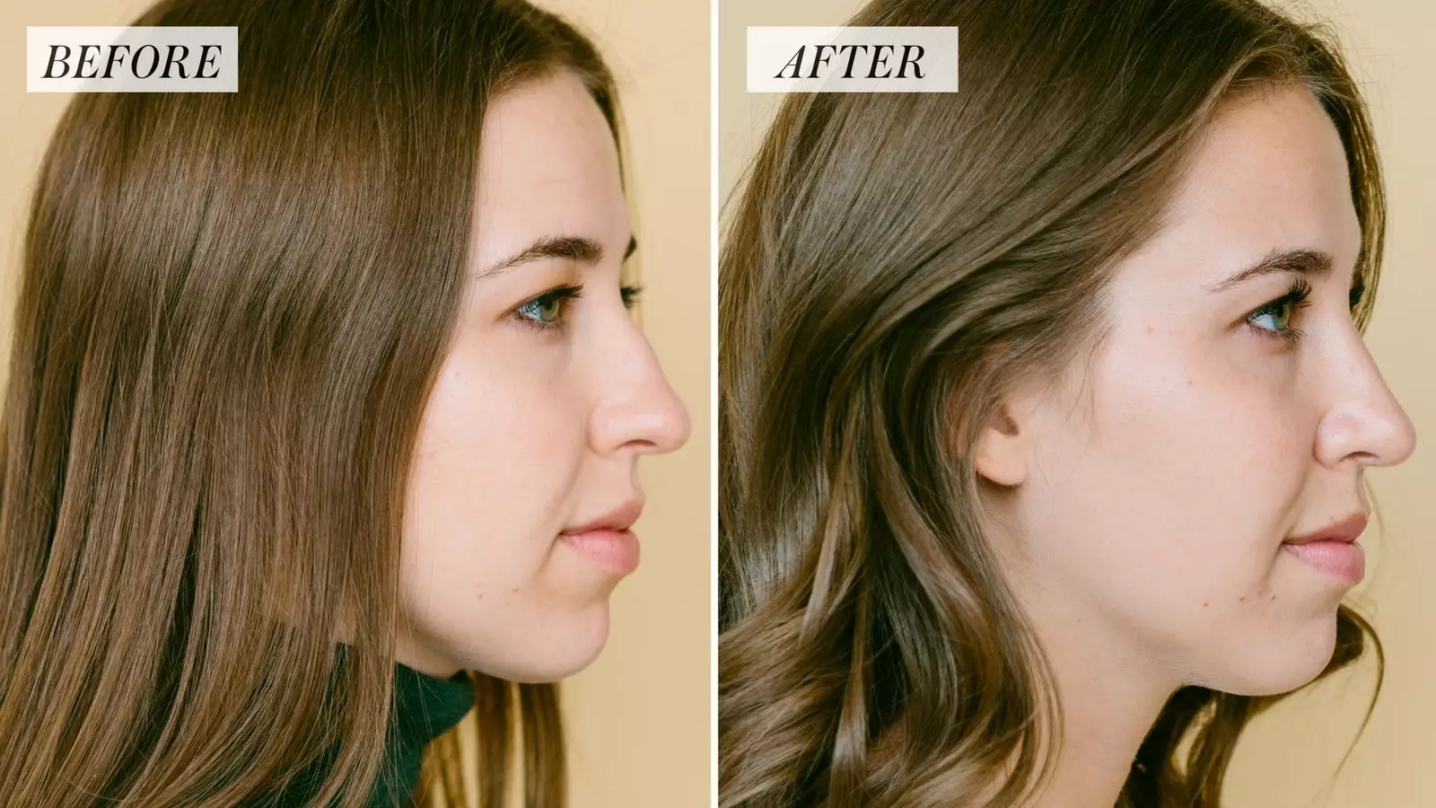 پلاسٹک کالم میں allure.com کی زندگی کے لیے rhinoplasty سے پہلے اور تصاویر